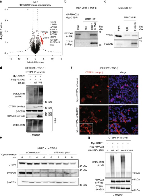 FBXO32 promotes microenvironment underlying epithelial-mesenchymal ...