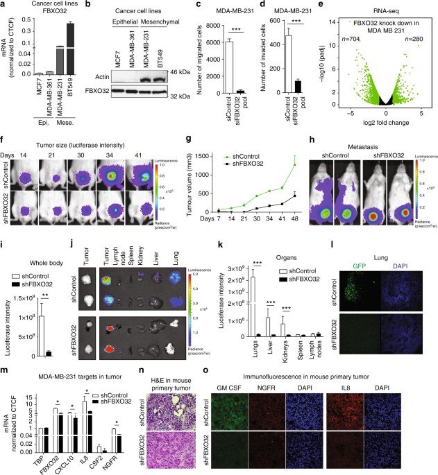 FBXO32 promotes microenvironment underlying epithelial-mesenchymal ...