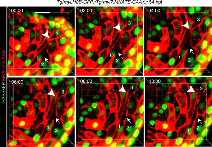 Transient cardiomyocyte fusion regulates cardiac development in ...