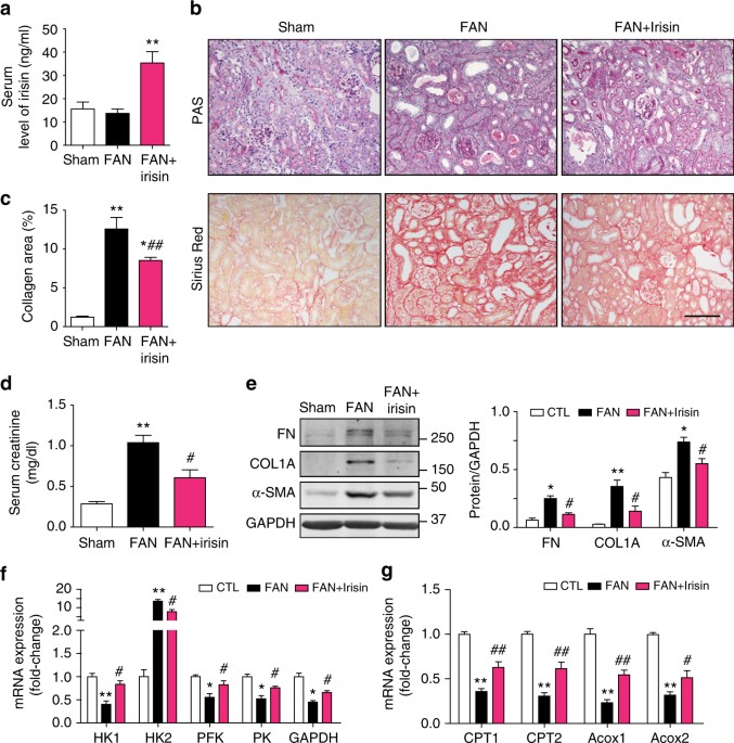 Myokine mediated muscle-kidney crosstalk suppresses metabolic ...