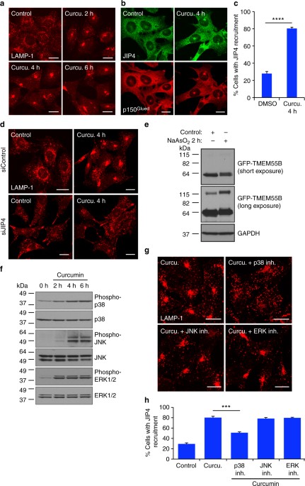 TFEB regulates lysosomal positioning by modulating TMEM55B expression ...