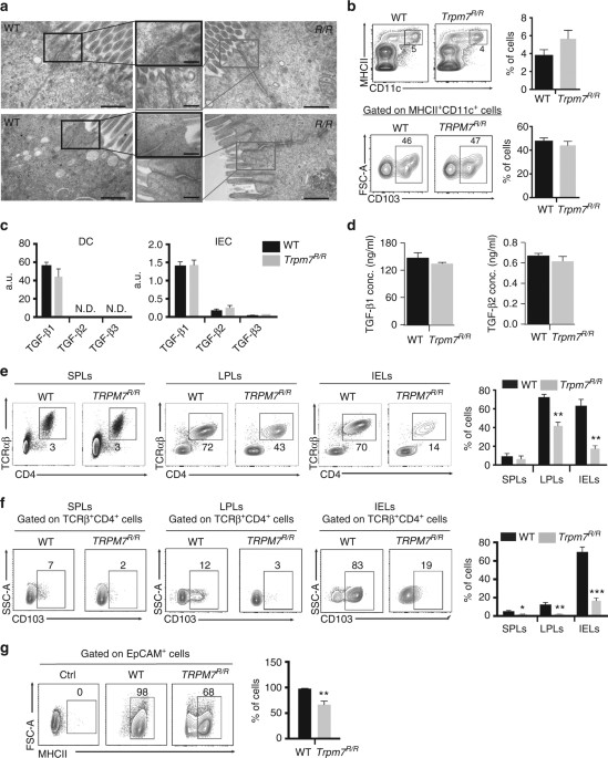 TRPM7 kinase activity is essential for T cell colonization and ...