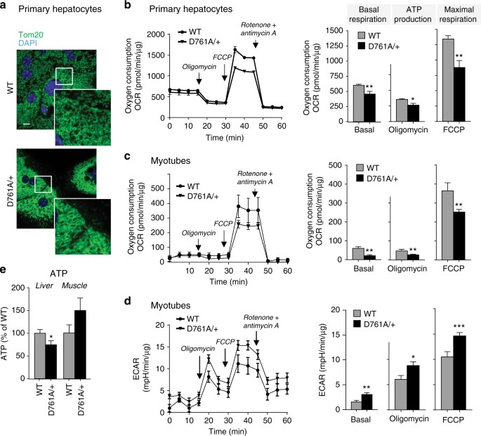 Vps34 PI 3-kinase inactivation enhances insulin sensitivity through ...
