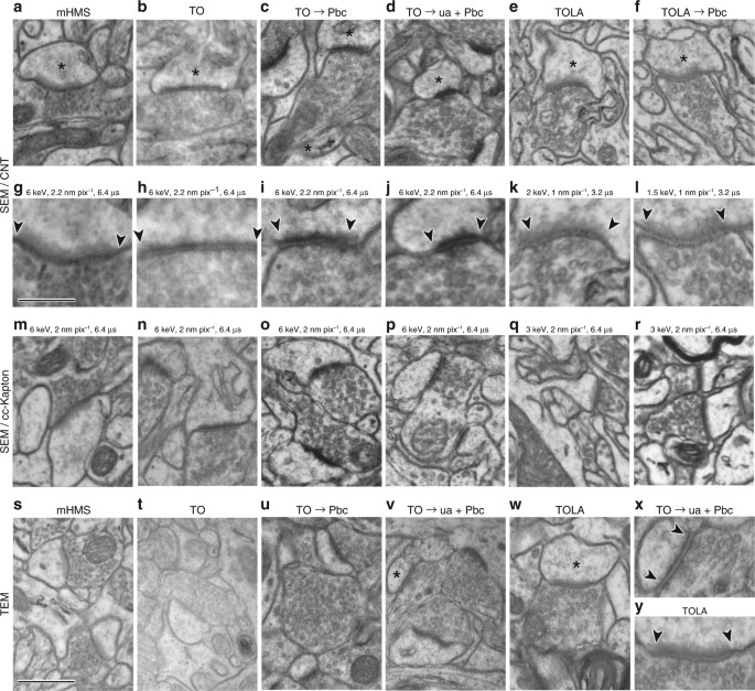 A carbon nanotube tape for serial-section electron microscopy of brain ...