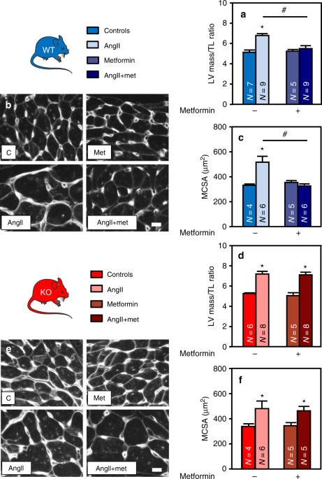 AMPK activation counteracts cardiac hypertrophy by reducing O-GlcNAcylation | Nature Communications