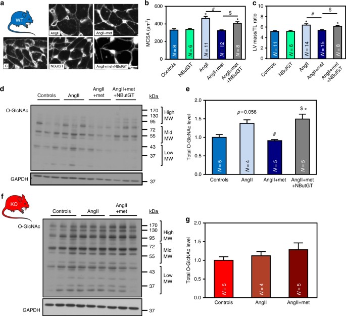 AMPK activation counteracts cardiac hypertrophy by reducing O-GlcNAcylation | Nature Communications