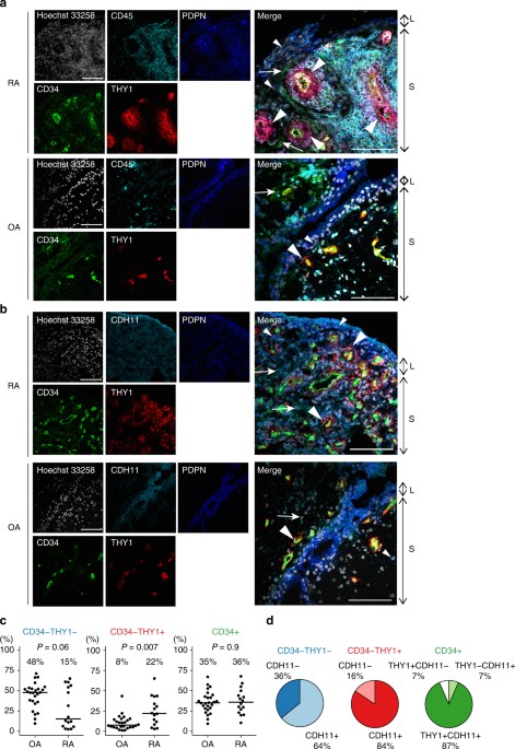 Functionally distinct disease-associated fibroblast subsets in ...