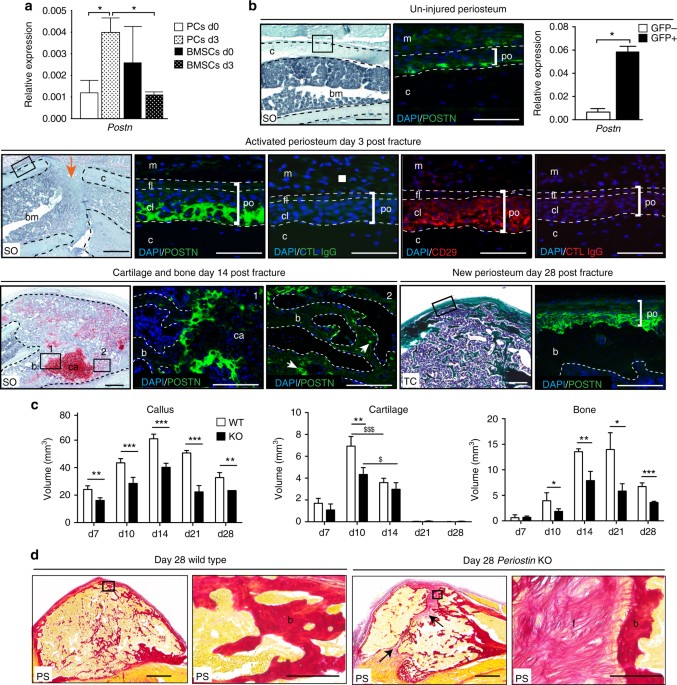 Periosteum contains skeletal stem cells with high bone regenerative ...