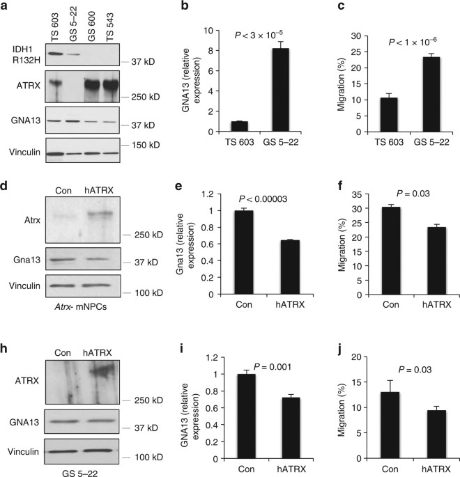 Atrx inactivation drives disease-defining phenotypes in glioma cells of ...
