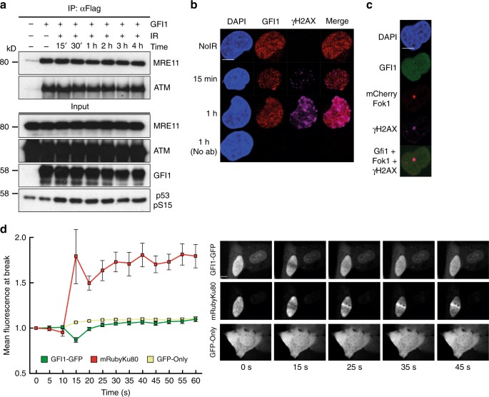 GFI1 facilitates efficient DNA repair by regulating PRMT1 dependent ...