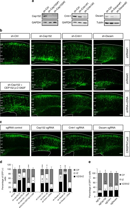Identification of genes associated with cortical malformation using a ...