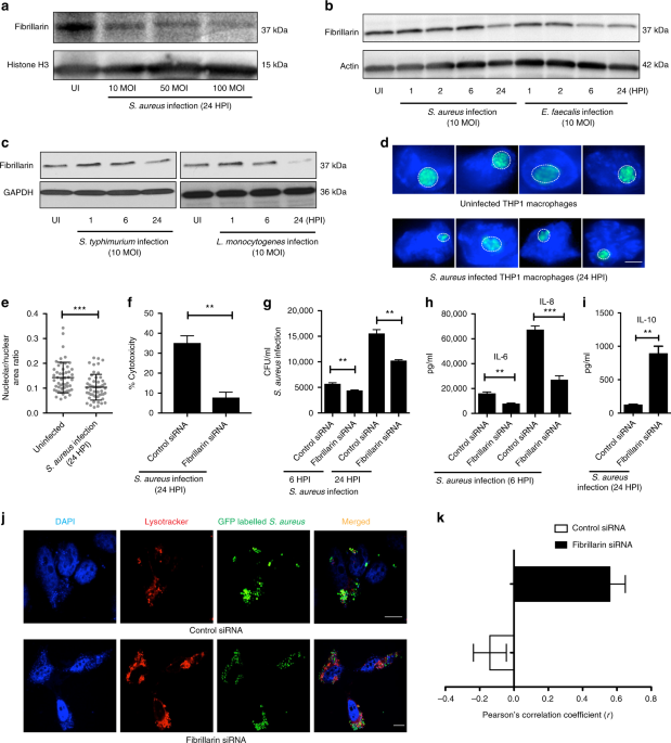 Nucleolar fibrillarin is an evolutionarily conserved regulator of ...