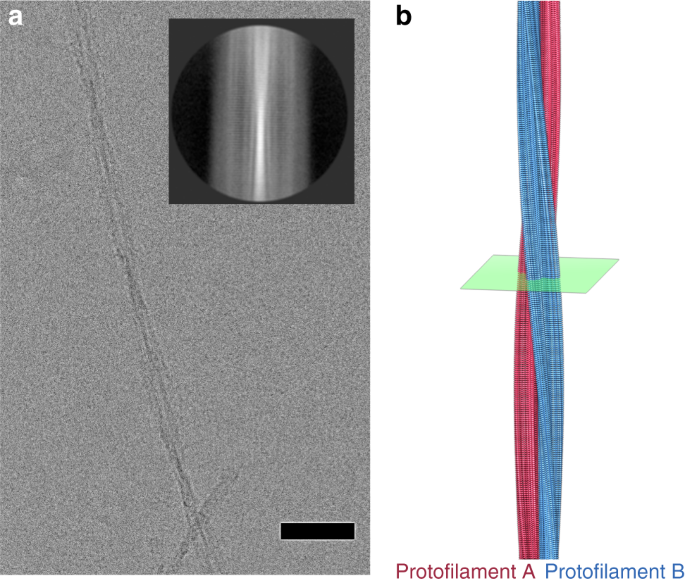 The structure of a β 2 -microglobulin fibril suggests a molecular basis ...