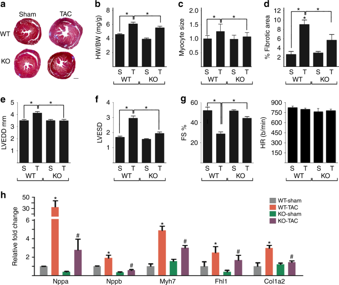 Histone lysine dimethyl-demethylase KDM3A controls pathological cardiac ...
