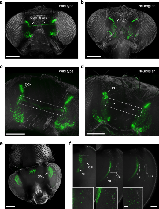 High-resolution ultramicroscopy of the developing and adult nervous ...