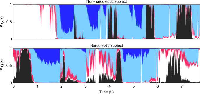 Neural network analysis of sleep stages enables efficient diagnosis of ...