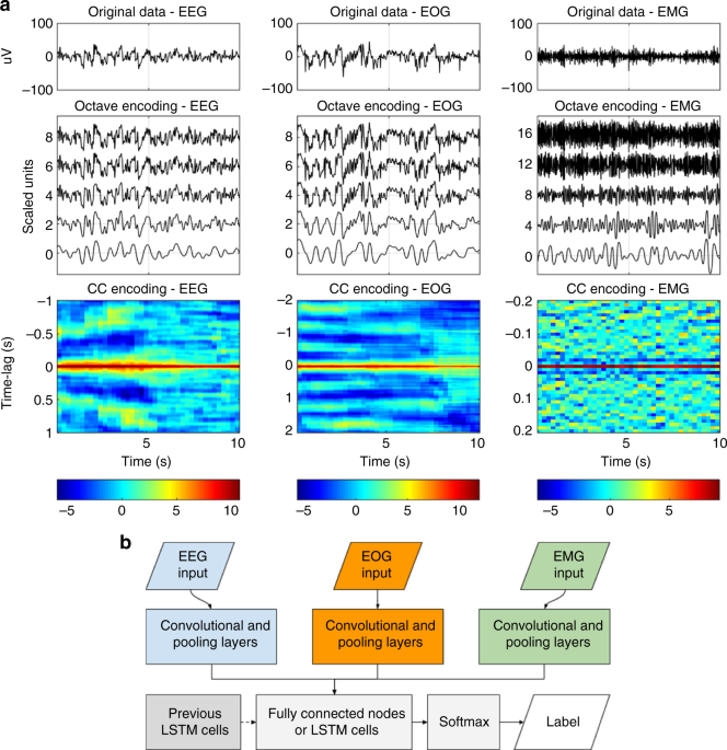 Neural network analysis of sleep stages enables efficient diagnosis of ...