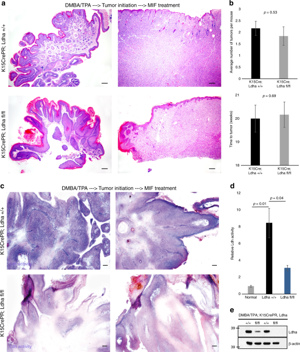 Increased lactate dehydrogenase activity is dispensable in squamous ...