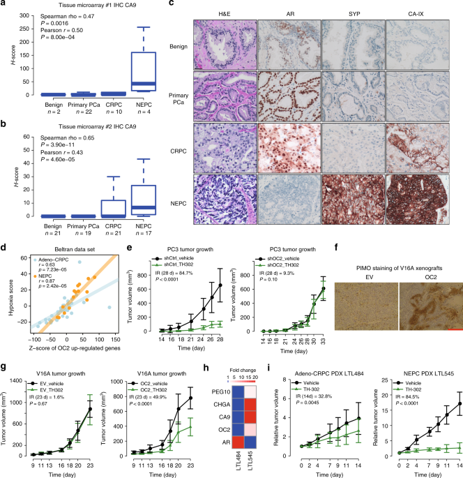 ONECUT2 is a driver of neuroendocrine prostate cancer | Nature ...