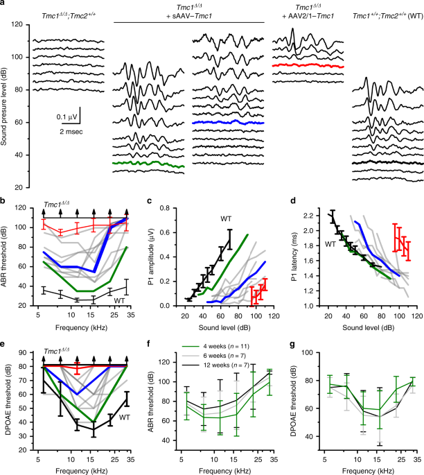 Improved TMC1 gene therapy restores hearing and balance in mice with ...