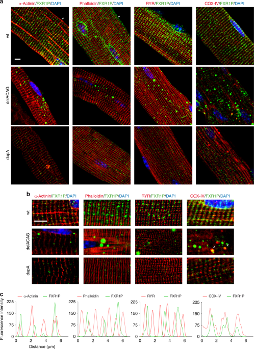 Recessive mutations in muscle-specific isoforms of FXR1 cause ...