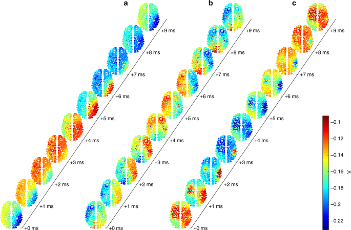 Metastable brain waves | Nature Communications