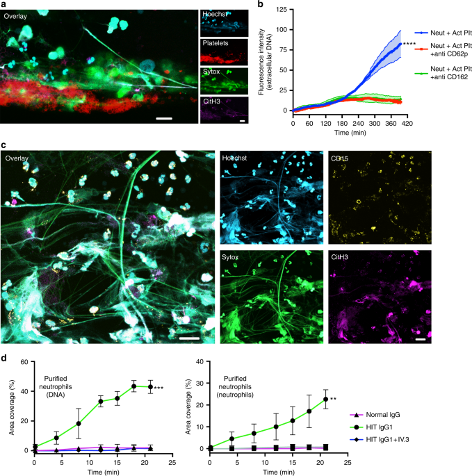 Neutrophil activation and NETosis are the major drivers of thrombosis ...