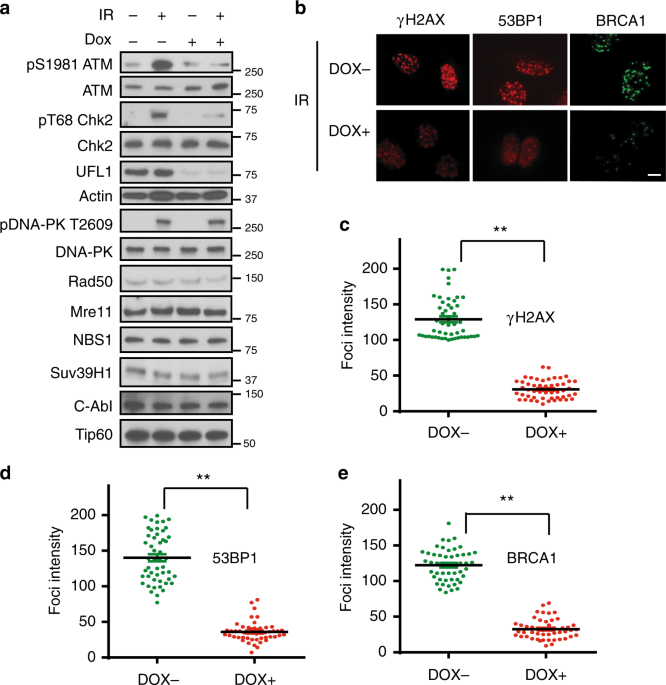 UFL1 promotes histone H4 ufmylation and ATM activation | Nature ...