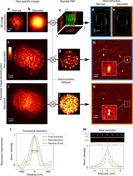 Compressive three-dimensional super-resolution microscopy with speckle-saturated fluorescence ...