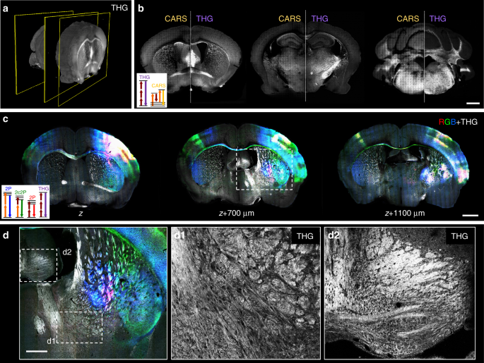 Multicolor multiscale brain imaging with chromatic multiphoton serial ...