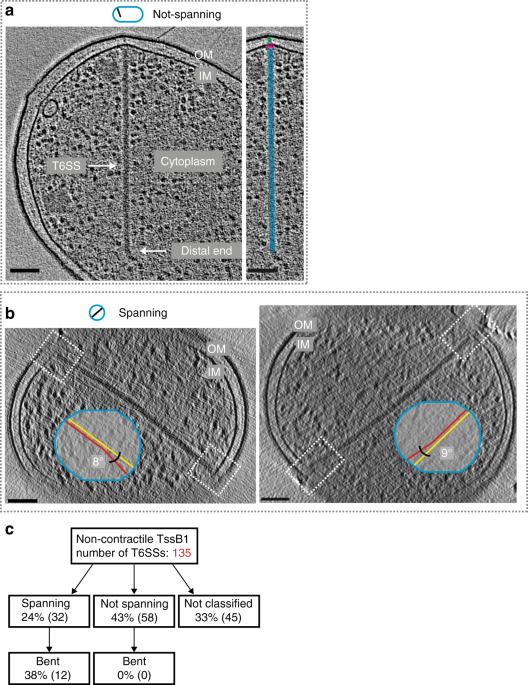 Bidirectional contraction of a type six secretion system | Nature ...