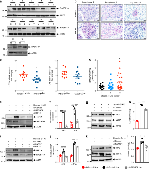 A RASSF1A-HIF1α loop drives Warburg effect in cancer and pulmonary hypertension | Nature ...