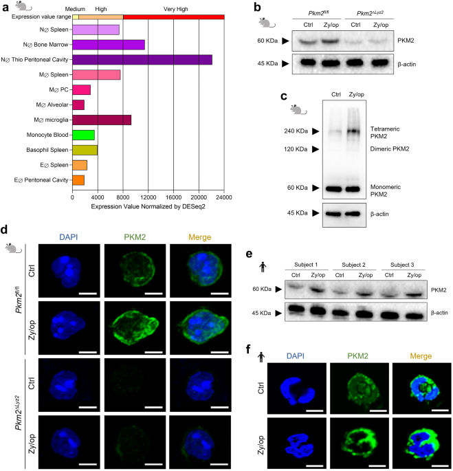 The metabolic function of pyruvate kinase M2 regulates reactive oxygen ...