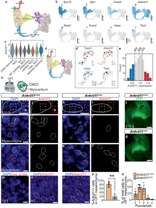 The chromatin regulator Ankrd11 controls cardiac neural crest cell ...