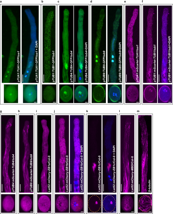 Distinct functions of microtubules and actin filaments in the ...