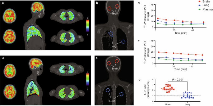 Dynamic PET reveals compartmentalized brain and lung tissue antibiotic ...