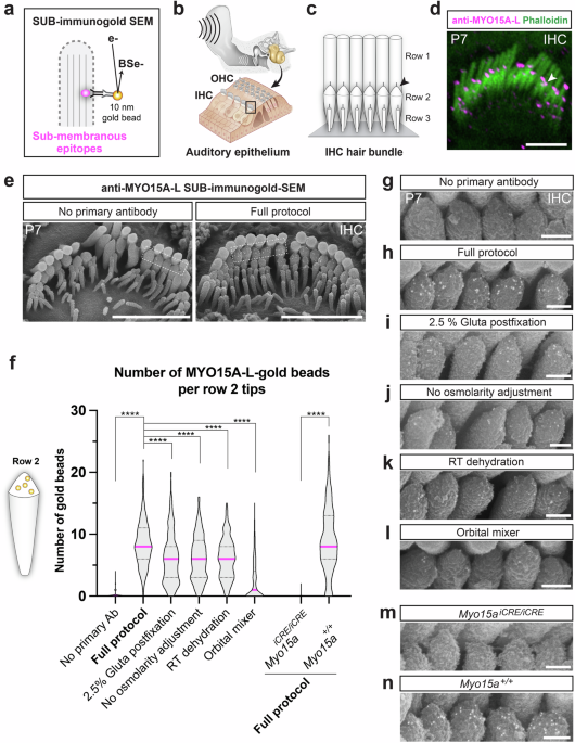 SUB-immunogold-SEM reveals nanoscale distribution of submembranous ...