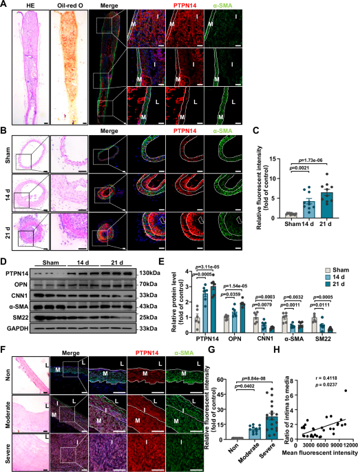 PTPN14 aggravates neointimal hyperplasia via boosting PDGFRβ signaling ...