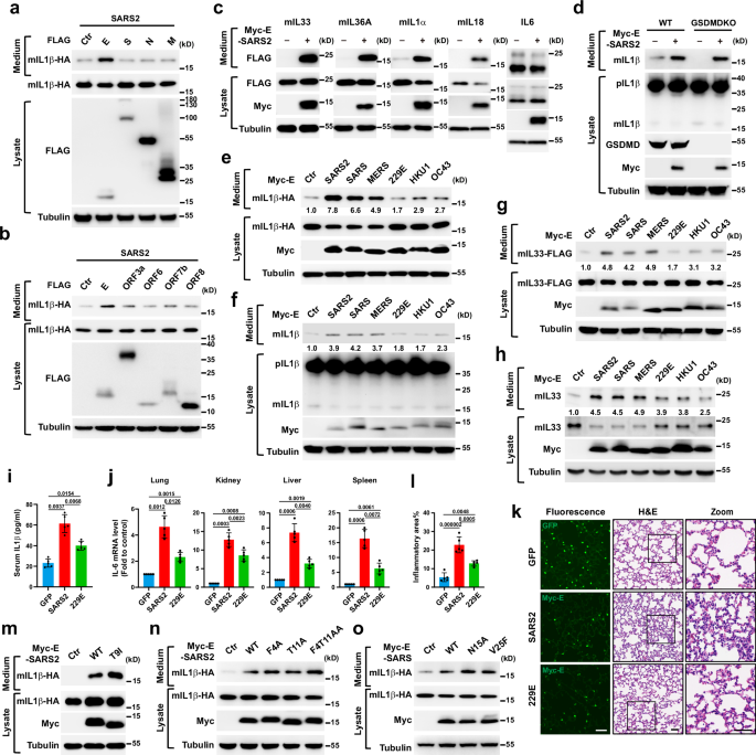 Coronavirus envelope protein activates TMED10-mediated unconventional ...