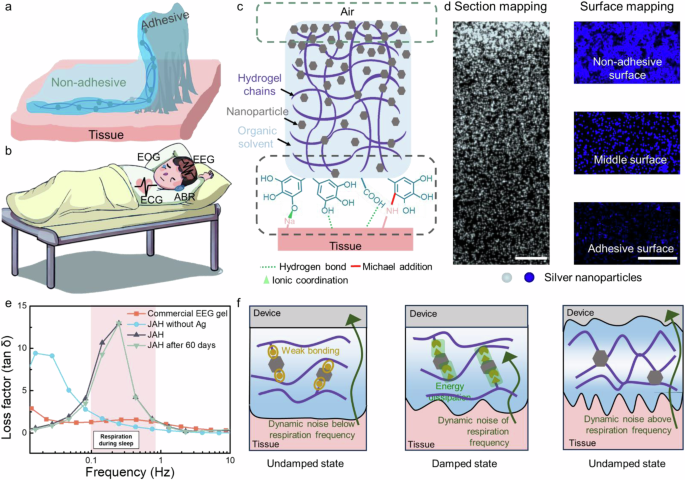 A selective frequency damping and Janus adhesive hydrogel as ...