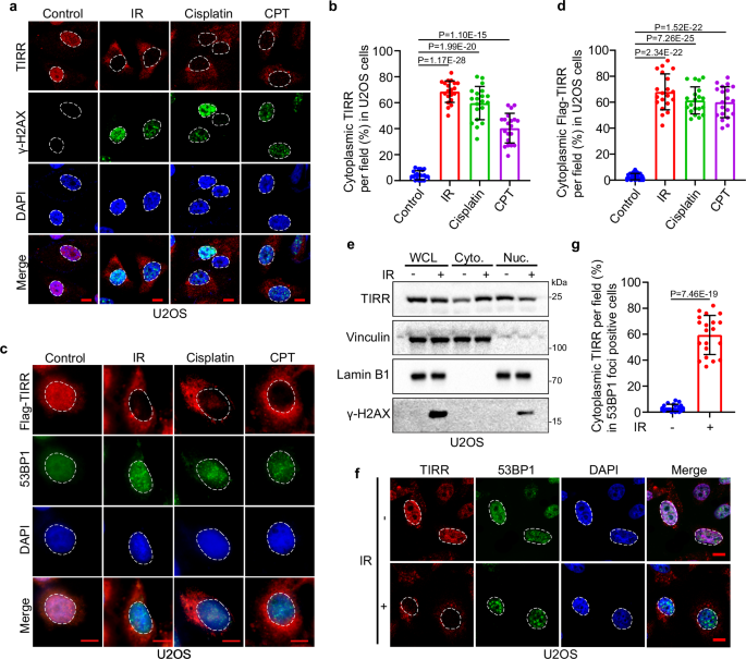 DTX3L-mediated TIRR nuclear export and degradation regulates DNA repair ...