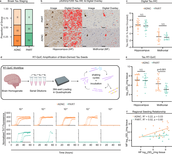 Early Alzheimer’s Disease with frequent neuritic plaques harbors ...