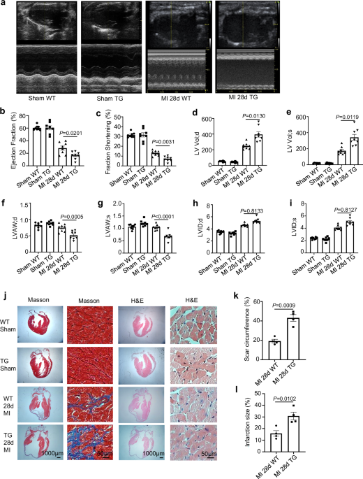 S100A12 triggers NETosis to aggravate myocardial infarction injury via ...