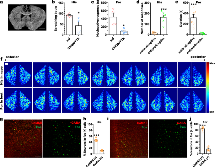 Processing of pain and itch information by modality-specific neurons ...