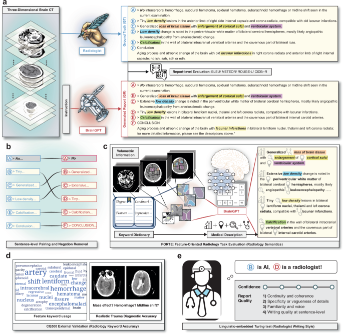 Towards a holistic framework for multimodal LLM in 3D brain CT radiology report generation ...