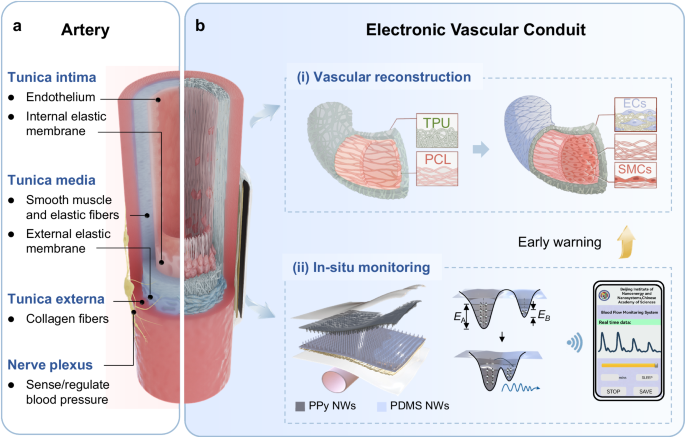 Electronic vascular conduit for in situ identification of ...