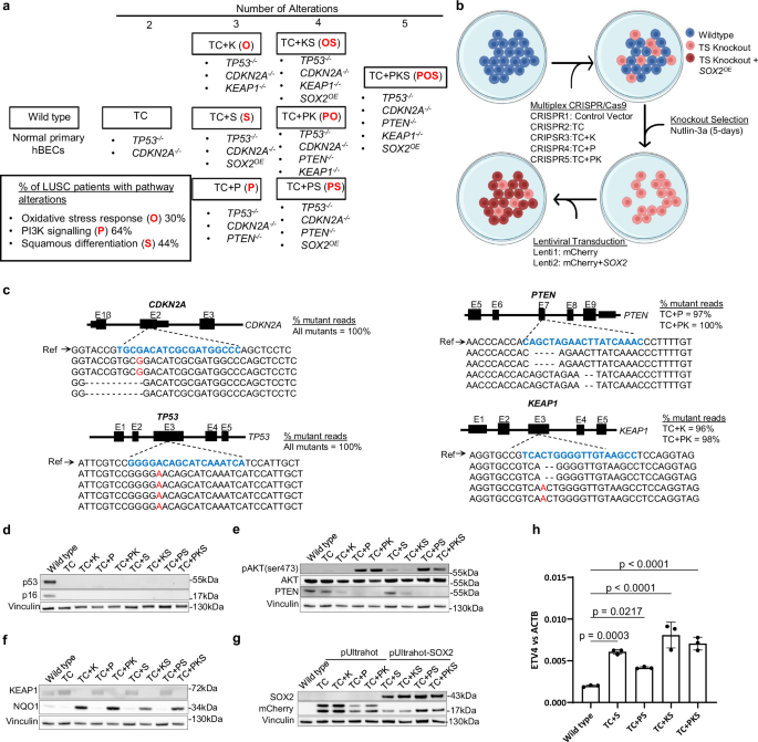 A human model to deconvolve genotype-phenotype causations in lung ...
