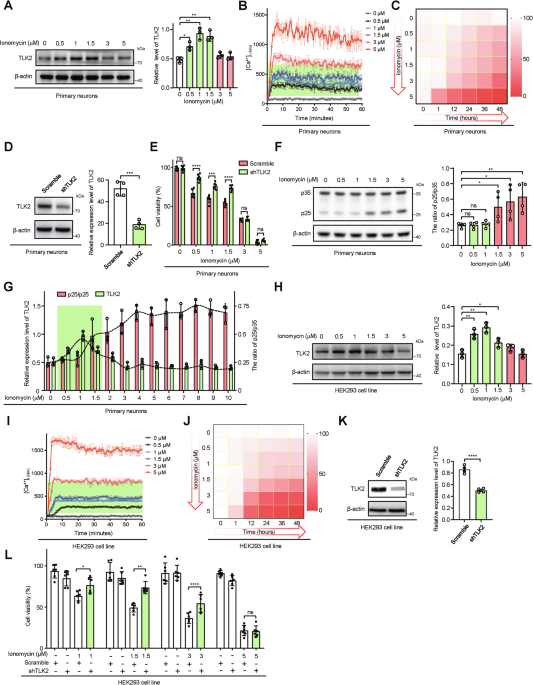 A TLK2-mediated calcium-driven cell death pathway links neuronal ...