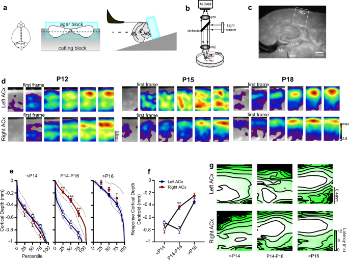 Asynchronous development of the mouse auditory cortex is driven by ...