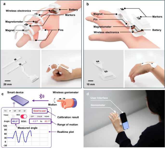Soft, skin-interfaced wireless electrogoniometry systems for continuous monitoring of finger and ...